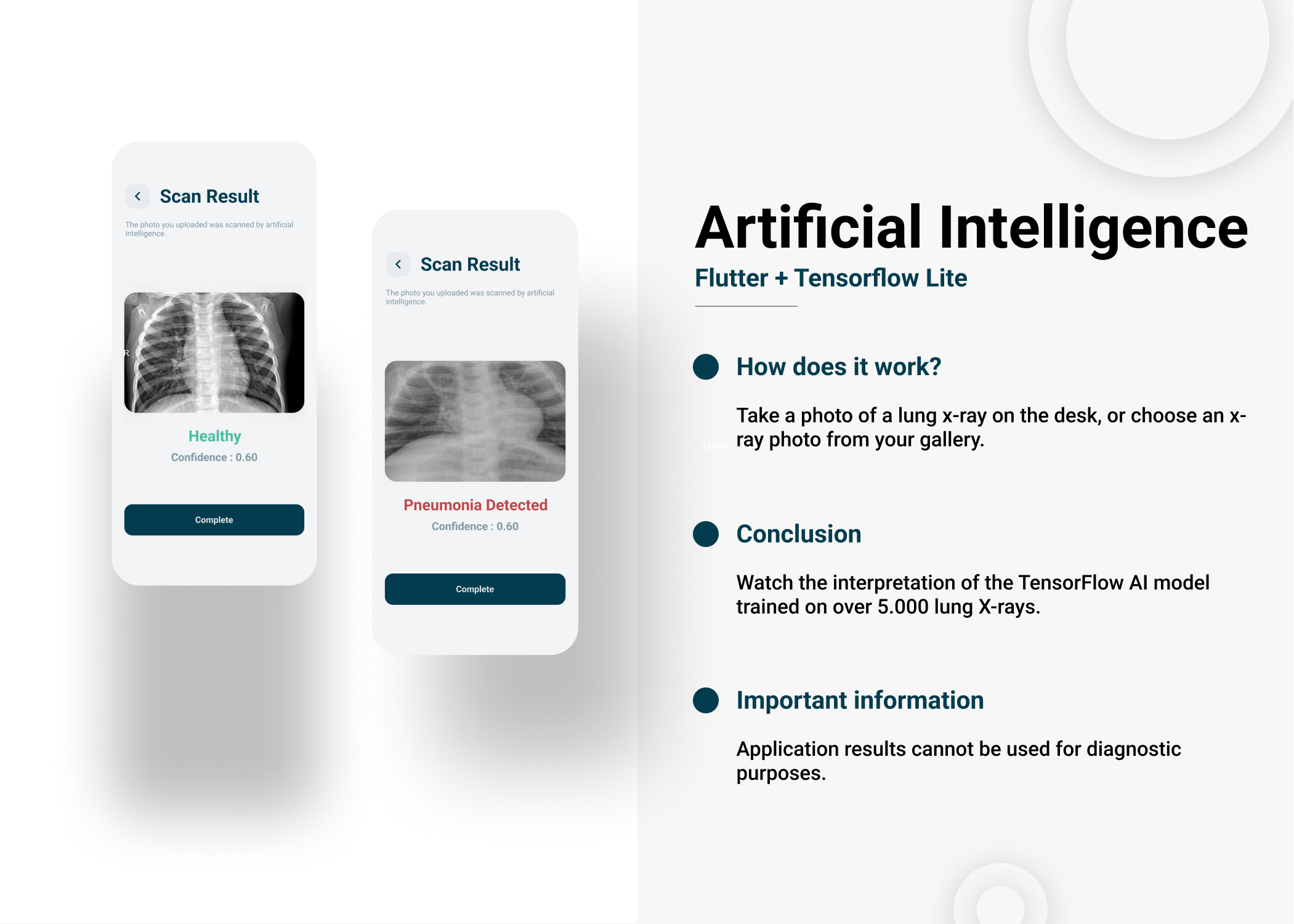 Flutter TensorFlow Artificial Intelligence Detection Of Lungs Pneumonia ... Flutter TensorFlow Artificial Intelligence Detection Of Lungs Pneumonia ...